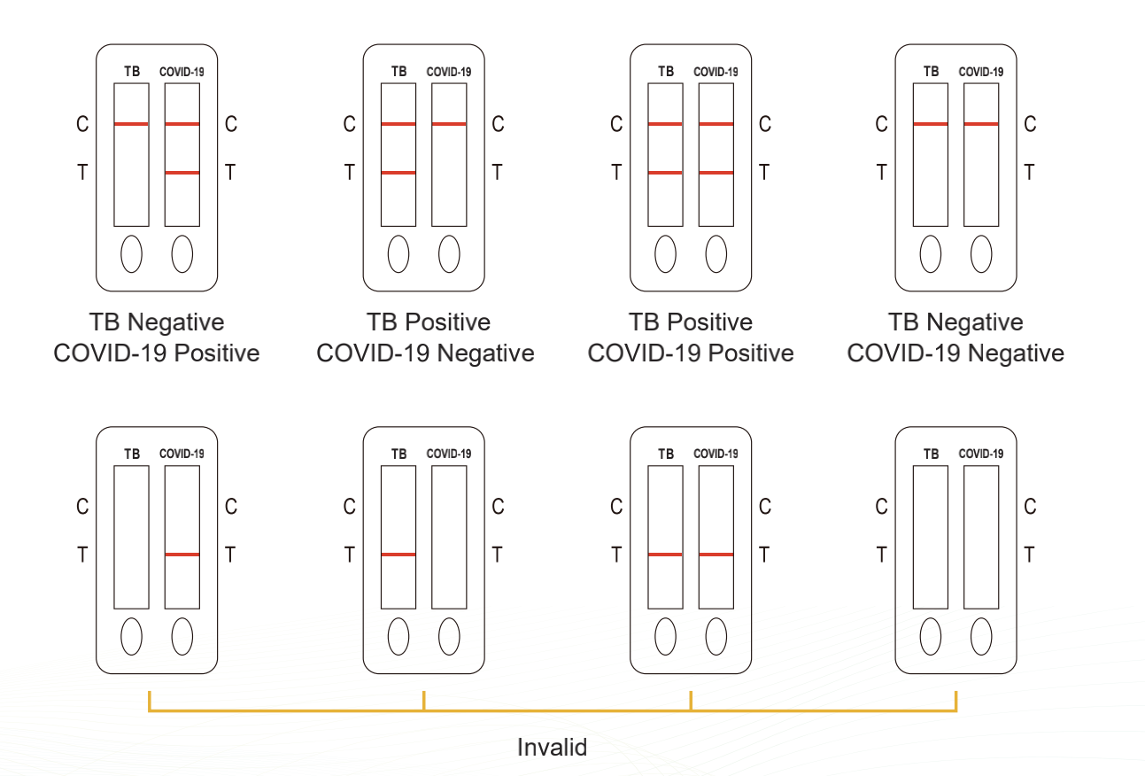 SARS-CoV-2 / Tuberculosis Antigen Combo Rapid Test Kit (Colloidal Gold ...